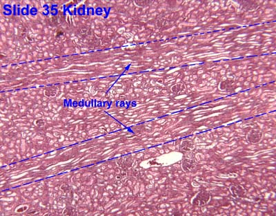 Kidney Slide Labeled